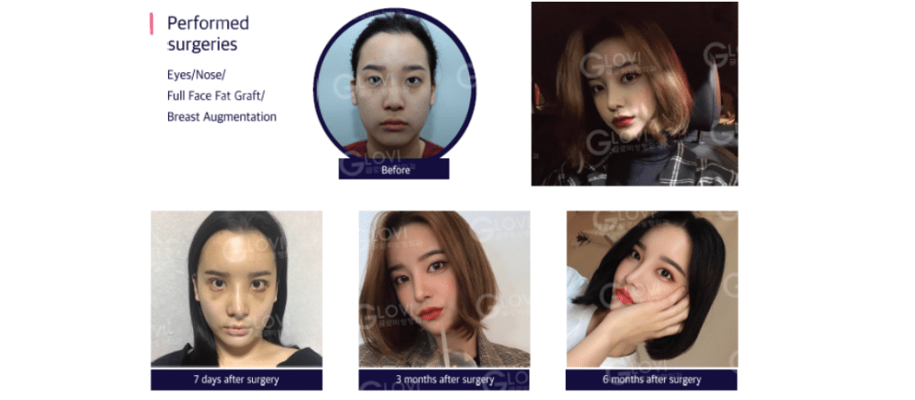 Glovi Plastic Surgery - Universal Medical Travel