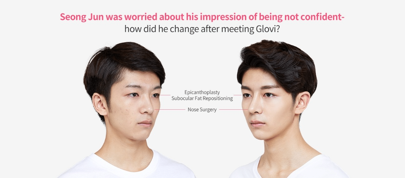 Korean Male Actor Plastic Surgery Before and After - UMT